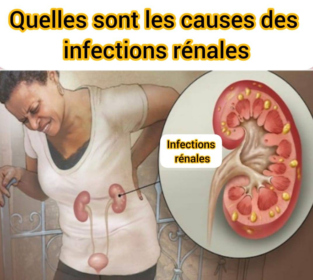 Remède naturel pour les problèmes des reins