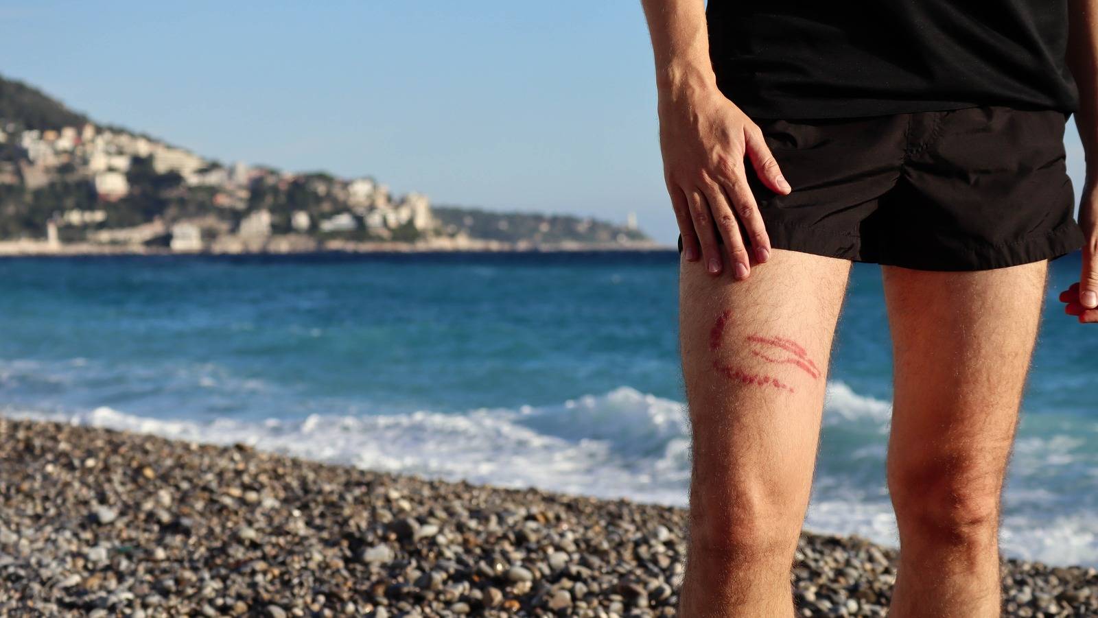 ⚠️ Never Pee on a Jellyfish Sting: Here's Why -- Little-Known National Parks -- And More