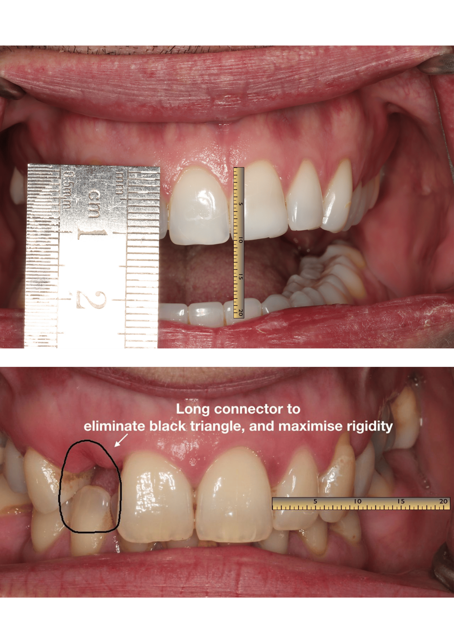 DSD Templates with Ruler