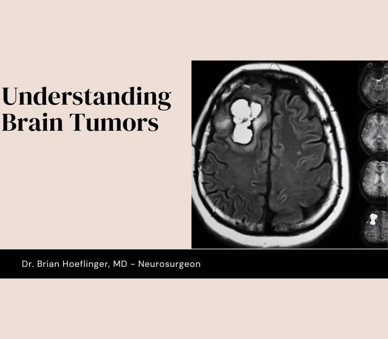 Understanding Brain Tumors - A Neurosurgeon's Perspective
