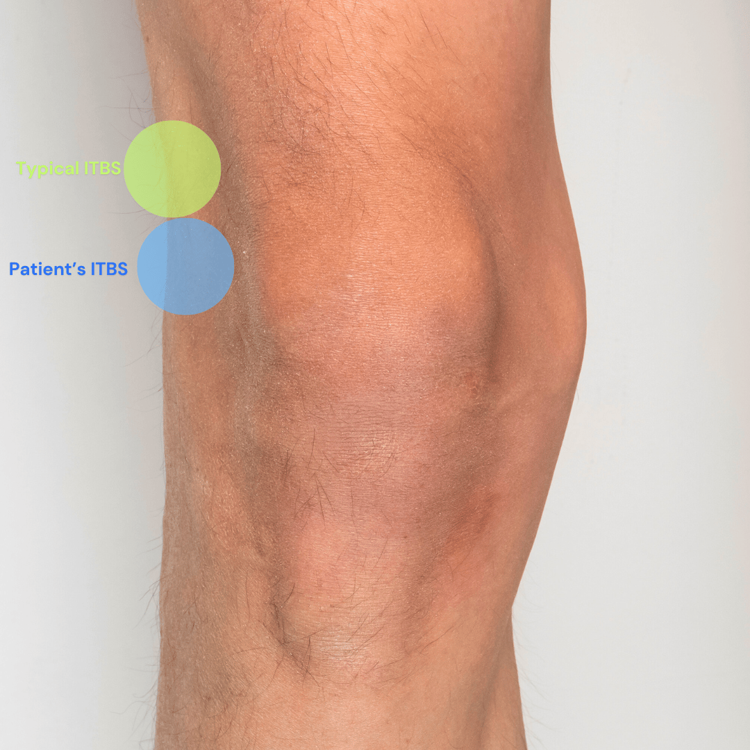 The 4 types of knee pain - Nathan Carlson - Running Mate