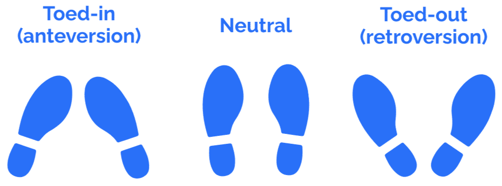 Do you need to fix a heel whip? - Nathan Carlson - Running Mate